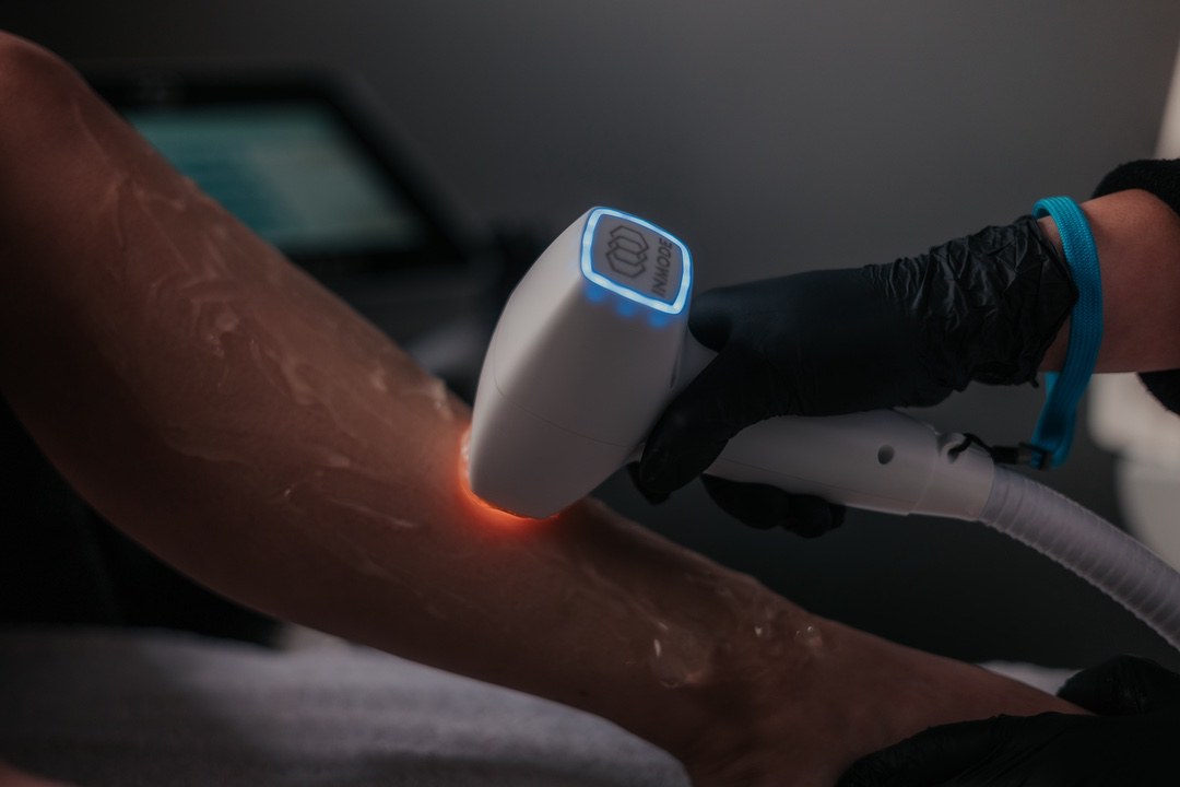 Laser-Haarentfernung mit Diolaze XL • Margarita M. Cosmetics